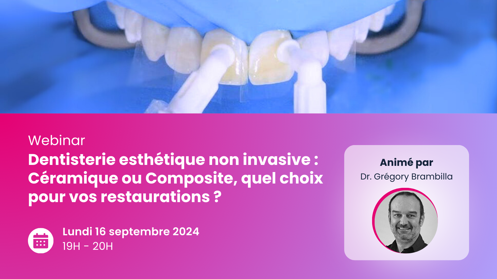 Dentisterie esthétique non invasive : Céramique ou Composite, quel ...