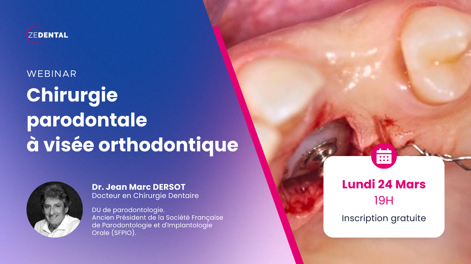 Orthodontie & Parodontie : comment faire équipe pour révéler les dents ...